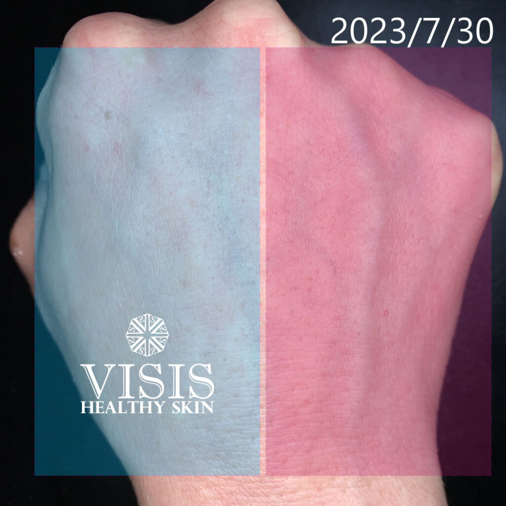 VISIS式角質保水理論 - 【公式】VISIS HEALTHY SKIN本当の潤いを感じる